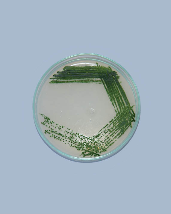 GNY :: Renewable Green Fuel from Marine Microalgae